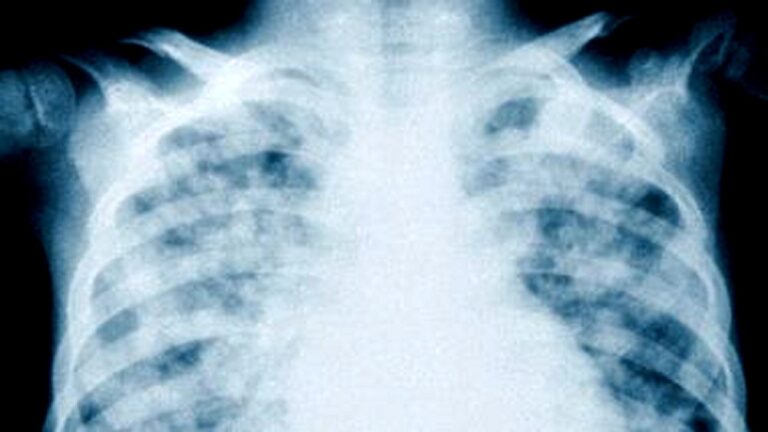 Wayne Rowland - Wayne Rowland